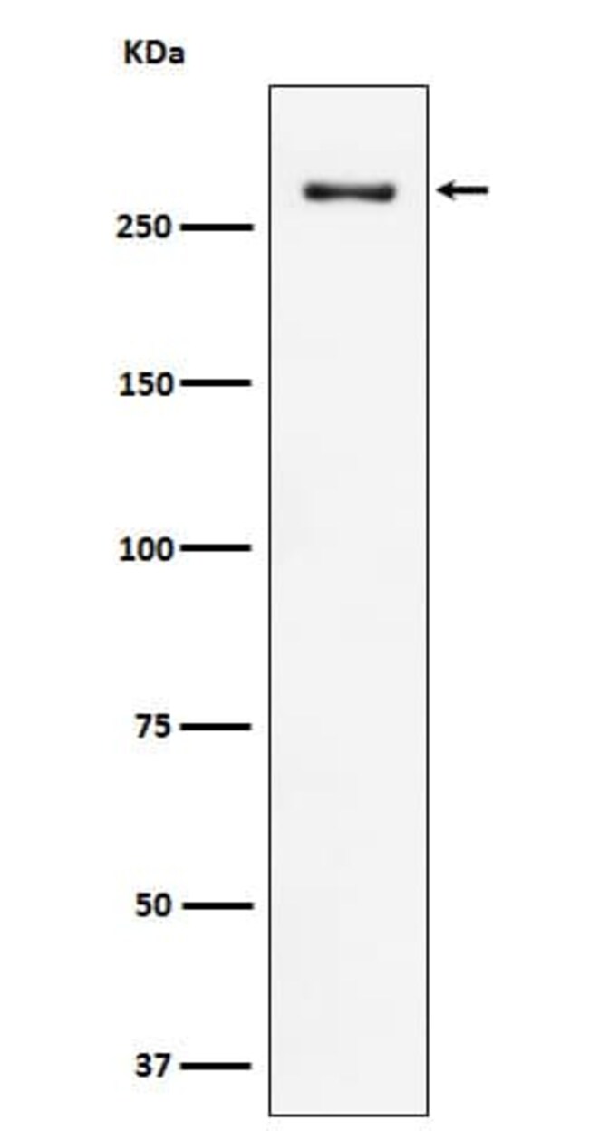 CHD3 Antibody (SR1410), Novus Biologicals 50 μg; Unconjugated ...