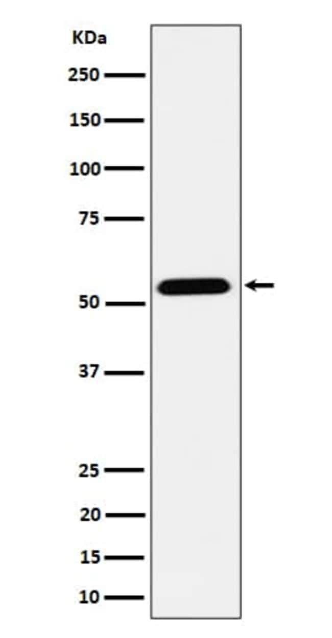 ENPP-5 Antibody (SR1988), Novus Biologicals 100 μg; Unconjugated ...