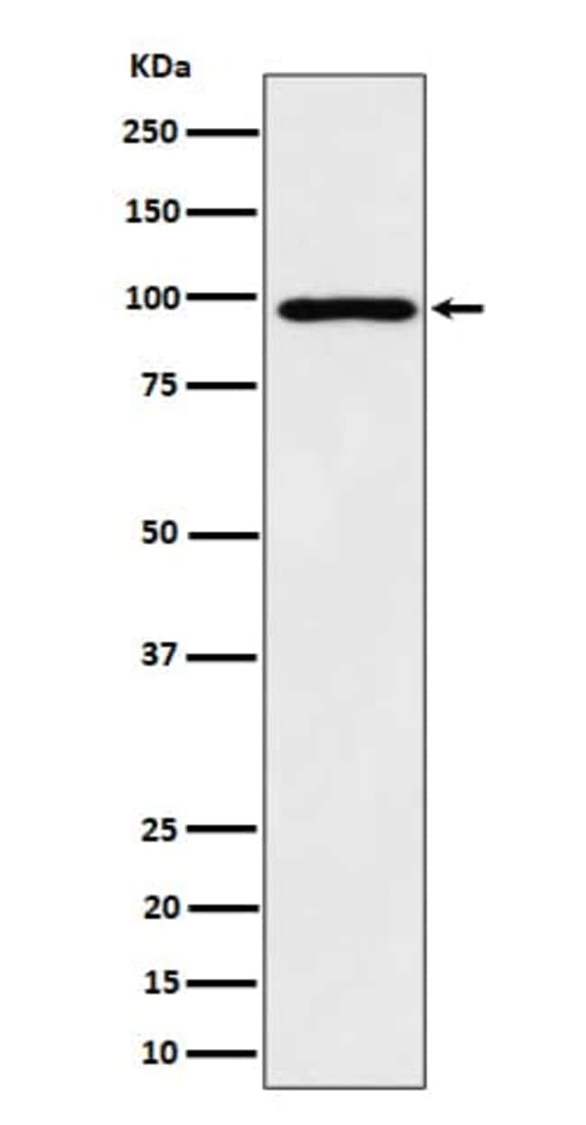 AKAP95/AKAP8 Antibody (SR2296), Novus Biologicals 50 μg; Unconjugated ...