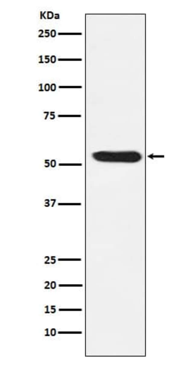 TEAD (pan) Antibody (SR1966), Novus Biologicals 50 μg; Unconjugated ...