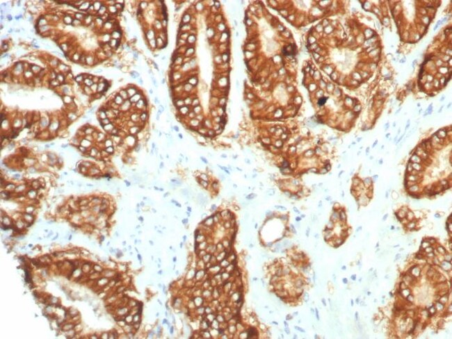 TROP-2 Antibody (TACSTD2/7349R), Novus Biologicals 20 μg, Unconjugated ...