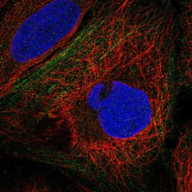 BPIFB4 Antibody, Novus Biologicals 100 μL, Unconjugated:Antibodies, | Fisher Scientific