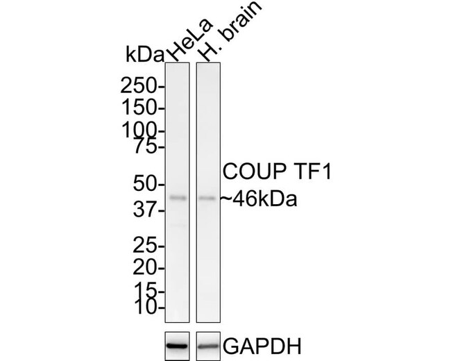 COUP-TF I/NR2F1 Antibody (JE31-95), Novus Biologicals 100 μL ...