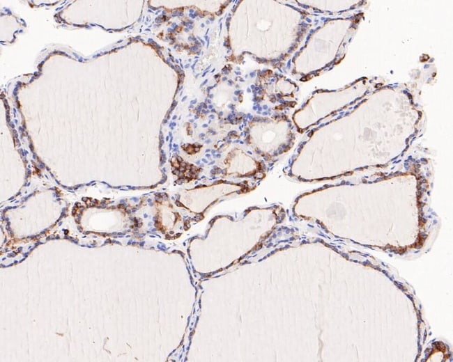Thyroid Peroxidase