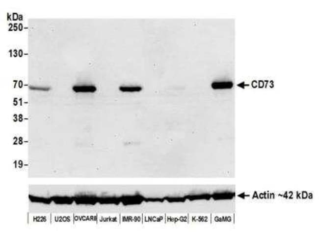 5'-Nucleotidase/CD73 Antibody (BLR054F), Novus Biologicals 100 μg ...