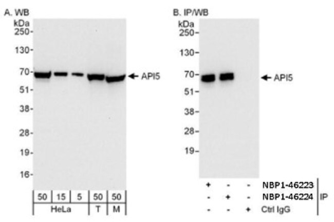 API5 Antibody, Novus Biologicals 0.1mL; Unlabeled:Antibodies, Polyclonal | Fisher Scientific