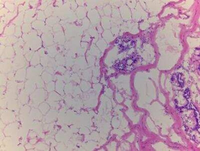 Novus Biologicals Adipose Tissue Slides (Adult Normal)- Frozen 5 Slides ...