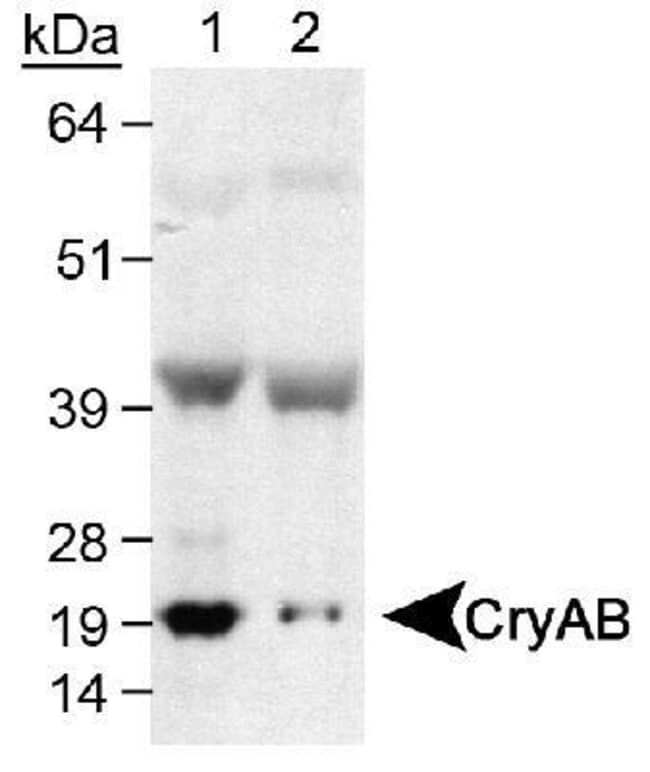 AlphaB Crystallin/CRYAB Antibody 0.1mL; Unlabeled:Antibodies ...