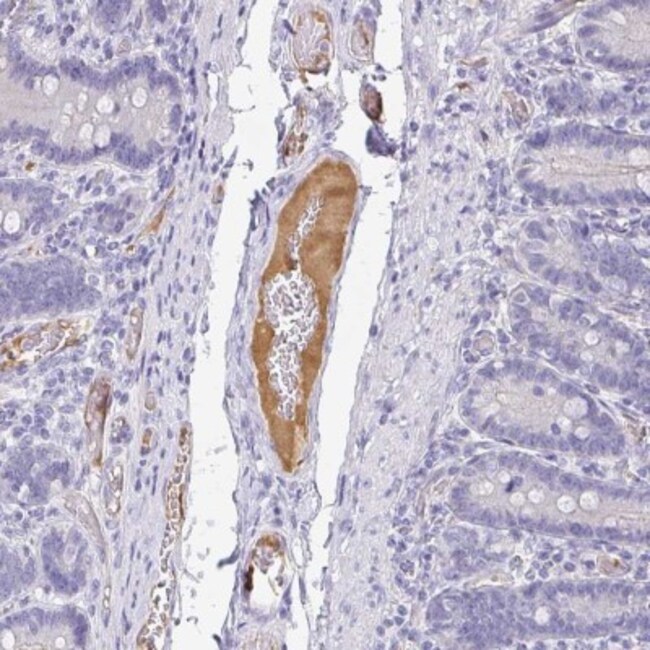 Apolipoprotein B/ApoB Antibody, Novus Biologicals:Antibodies:Primary ...