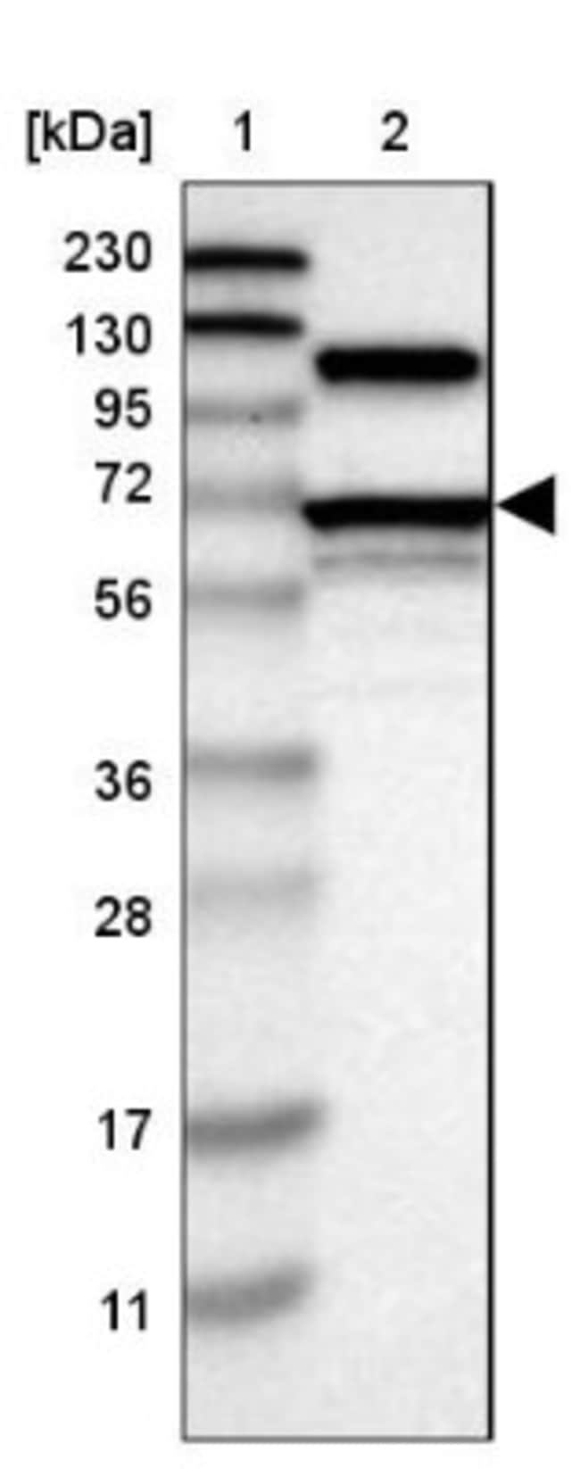 Arginyl tRNA synthetase Antibody, Novus Biologicals 25 μL; Unlabeled ...