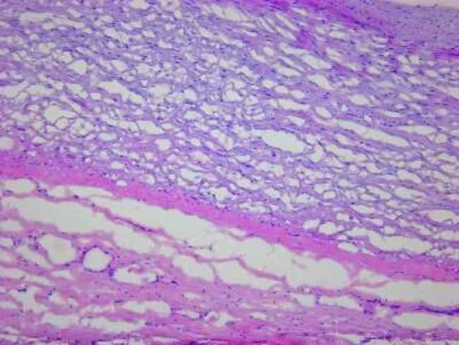 Novus Biologicals Artery Tissue Slides (Hypertension)- Frozen 5 Slides ...