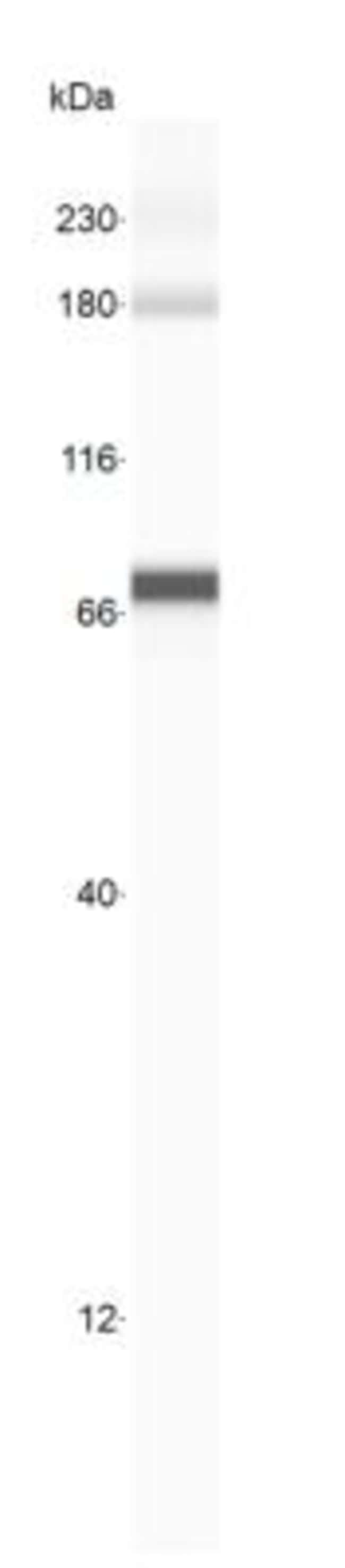 Asialofetuin Antibody, Novus Biologicals:Antibodies:Primary Antibodies ...