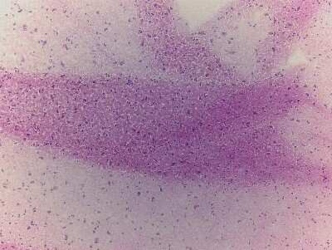 Novus Biologicals Brain Amygdala Tissue Slides (Adult Normal)- Frozen 5 ...