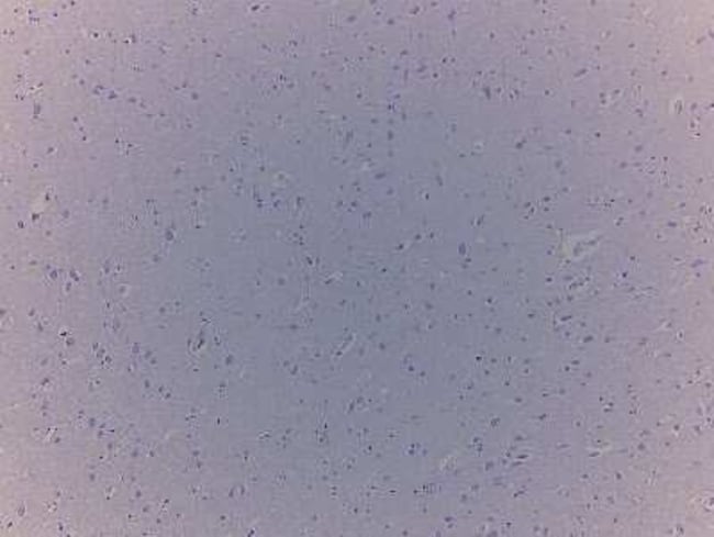 Novus Biologicals Brain Amygdala Tissue Slides (Adult Normal)- Paraffin ...