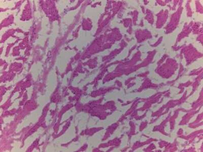 Novus Biologicals Brain Cerebellum Tissue Slides (Adult Normal Left ...