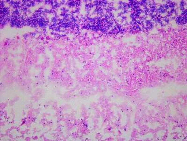 Novus Biologicals Brain Cerebellum Tissue Slides (Parkinson's)- Frozen ...