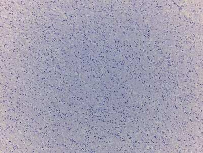 Novus Biologicals Brain Corpus Callosum Tissue Slides (Parkinson's ...