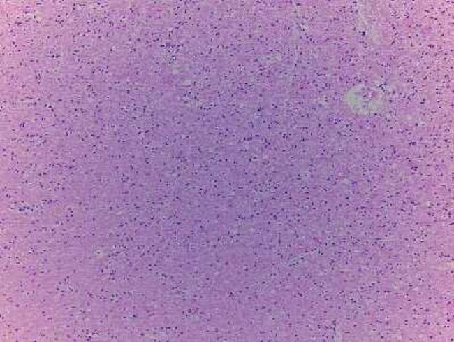 Novus Biologicals Brain Frontal Lobe Tissue Slides (Adult Normal ...