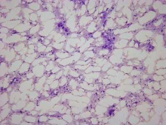 Novus Biologicals Brain Frontal Lobe Tissue Slides (Progressive ...