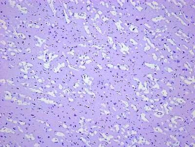 Novus Biologicals Brain Frontal Lobe Tissue Slides (Progressive ...