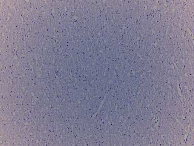 Novus Biologicals Brain Insula Tissue Slides (Adult Normal)- Paraffin 5 ...