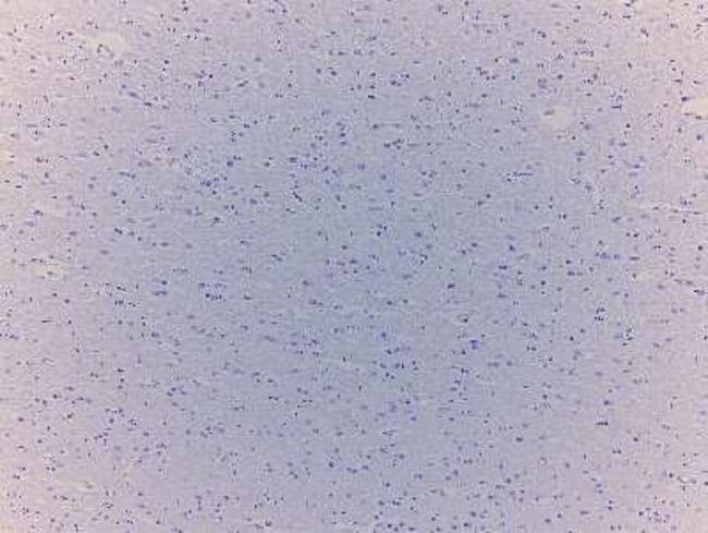 Novus Biologicals Brain Olfactory Tissue Slides (Adult Normal ...