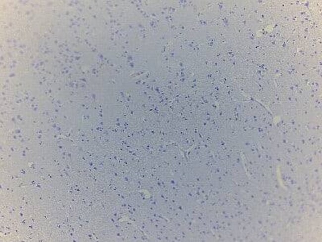 Novus Biologicals Brain Parietal Lobe Tissue Slides (Adult Normal ...