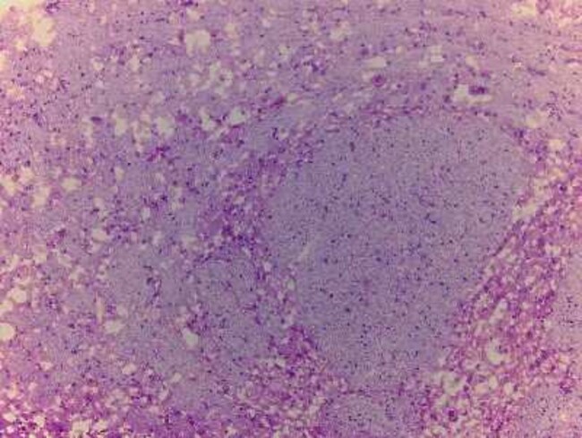 Novus Biologicals Brain Pons Tissue Slides (Multiple Sclerosis)- Frozen ...