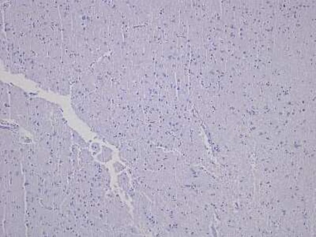 Novus Biologicals Brain Temporal Lobe Tissue Slides (Dementia ...