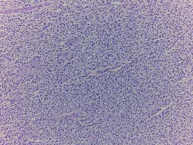 Novus Biologicals Brain Tissue Slides (Gliocytoma)- Paraffin 5 Slides ...