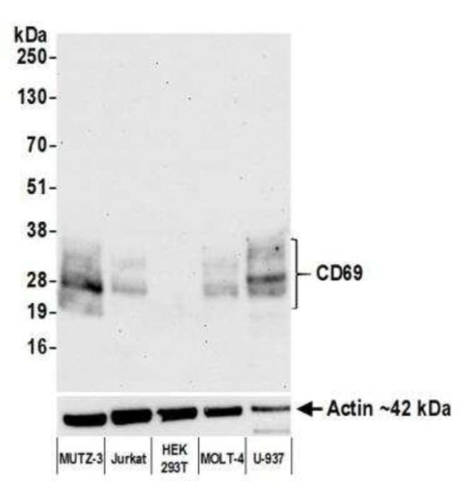 CD69 Antibody (BLR170J), Novus Biologicals 100 μg; Unconjugated ...