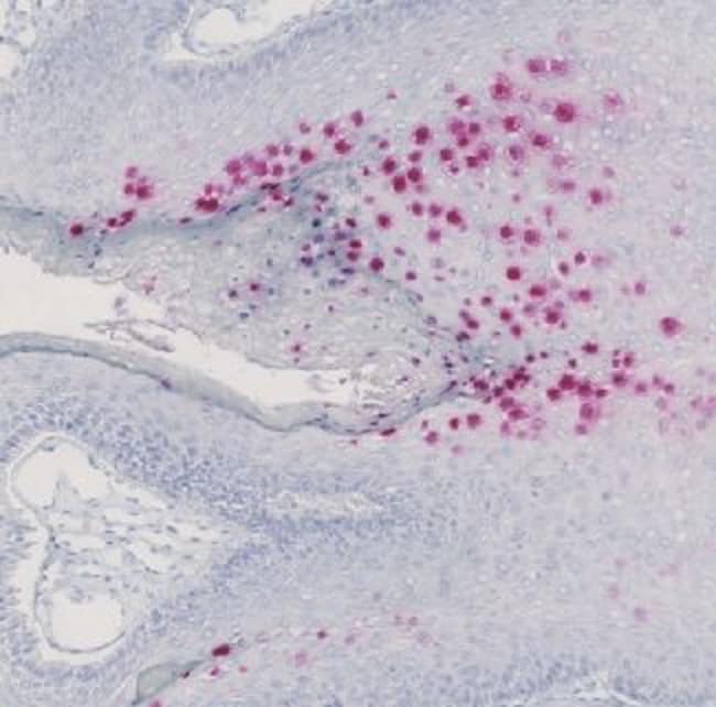 Abnova HPV type 6/11 CISH Probe HPV type 6/11 CISH Probe:Custom ...