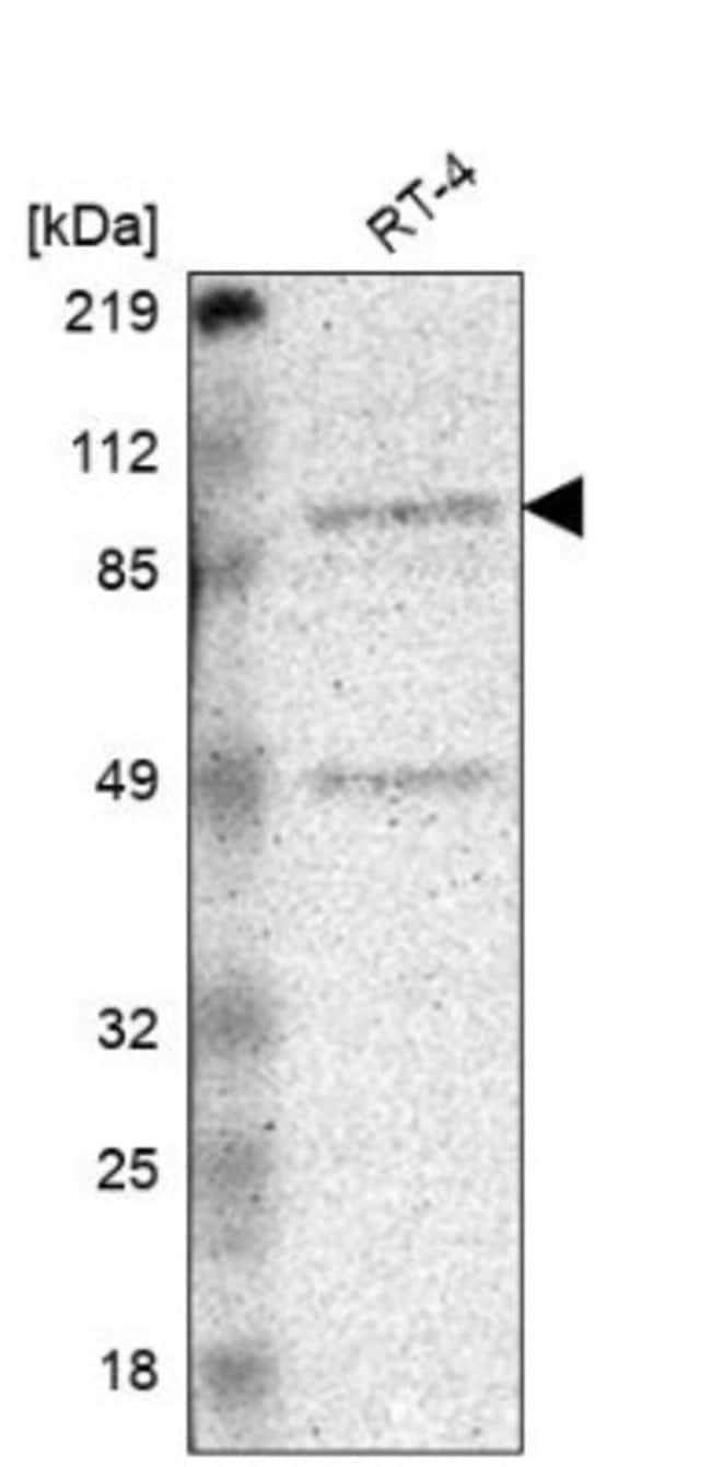 RADX Antibody, Novus Biologicals 0.1mL; Unlabeled:Antibodies ...