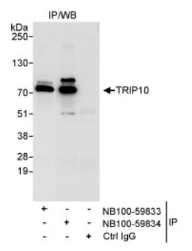 Cip4 Antibody 0.1mg; Unlabeled:Antibodies, Polyclonal | Fisher Scientific
