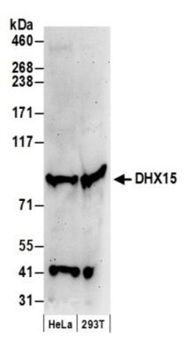 DHX15 Antibody 0.1mg; Unlabeled:Antibodies, Polyclonal | Fisher Scientific