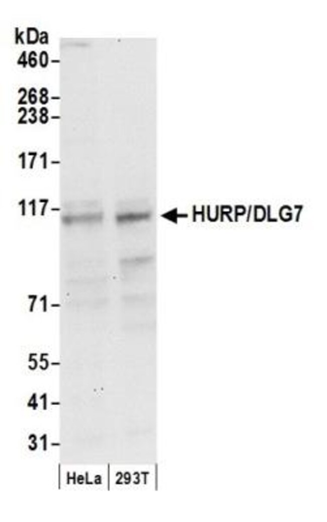DLG7/HURP Antibody 0.1mL; Unlabeled:Antibodies, Polyclonal | Fisher ...
