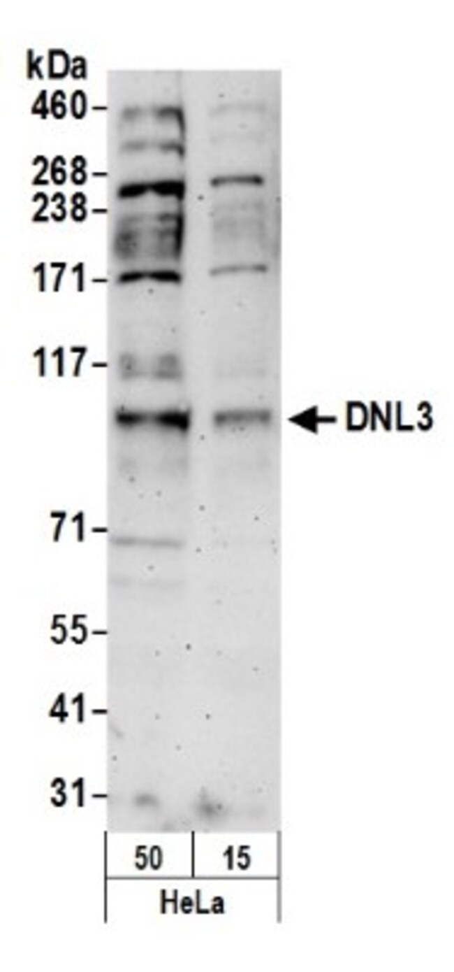 DNA Ligase III Antibody 0.1mL; Unlabeled:Antibodies, Polyclonal ...