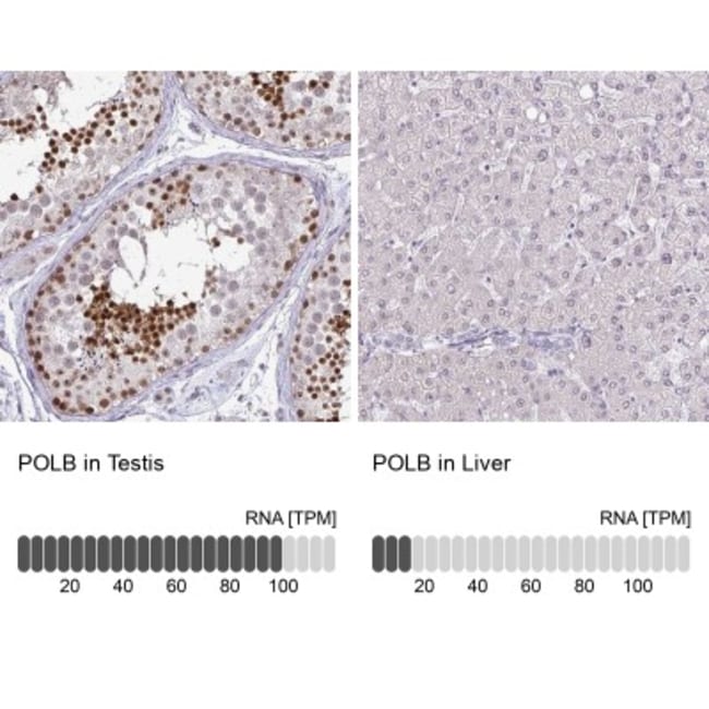 DNA POLYMERASE BETA - 0.1 ML