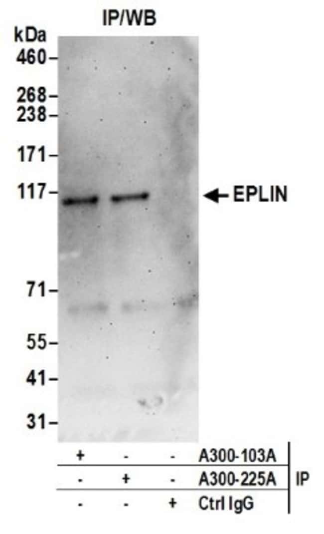 EPLIN Antibody 0.1mg; Unlabeled:Antibodies, Polyclonal | Fisher Scientific