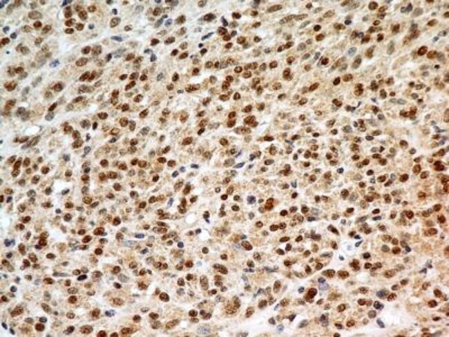FoxP1 Antibody (JC12) - BSA Free, Novus Biologicals 0.025mL; Unlabeled ...