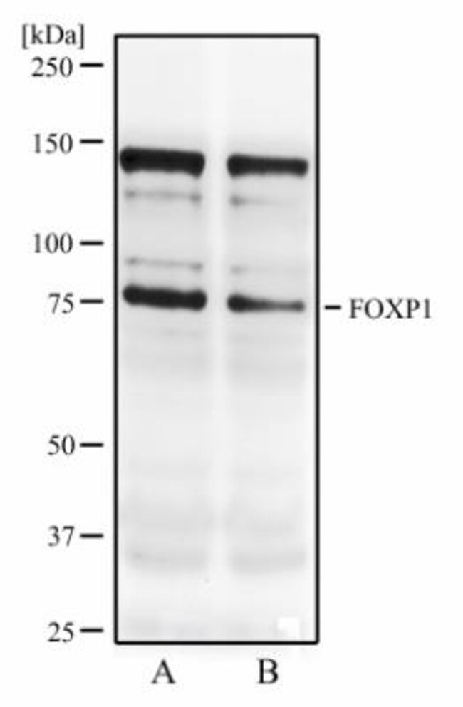 FoxP1 Antibody (JC12) - BSA Free, Novus Biologicals 0.025mL; Unlabeled ...