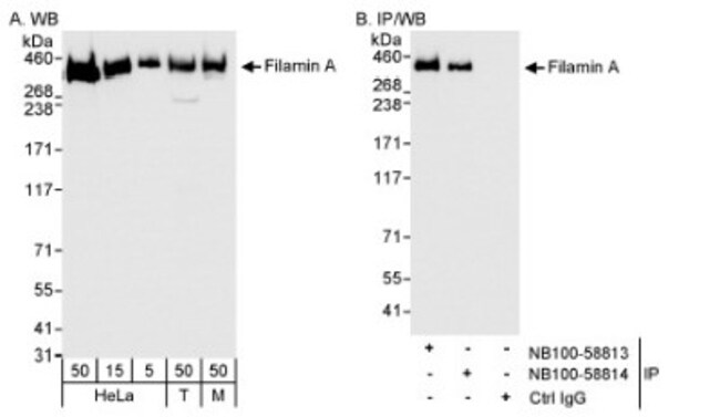 Filamin A Antibody 0.1mL; Unlabeled:Antibodies, Polyclonal | Fisher ...