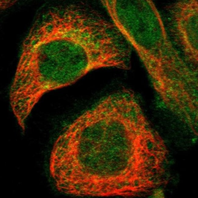 G protein alpha Inhibitor 2 Antibody, Novus Biologicals™ 0.1mL ...