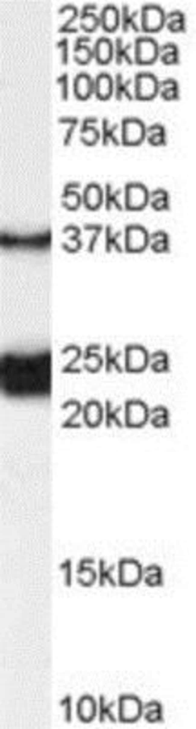 Galanin R1/GALR1 Antibody 0.1mg; Unlabeled:Antibodies, Polyclonal ...