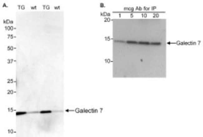 Galectin-7 Antibody 0.1mg; Unlabeled:Antibodies, Polyclonal | Fisher ...