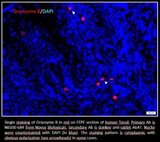 Granzyme B Antibody 0.5mL; Unlabeled:Antibodies, Polyclonal | Fisher ...