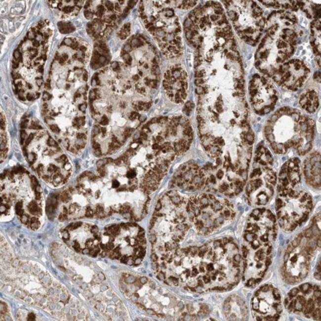 HPDL Antibody, Novus Biologicals 25 μL; Unlabeled:Antibodies ...