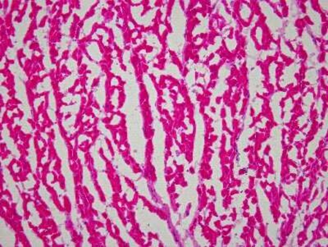 Novus Biologicals Heart Tissue Slides (Hypertension)- Frozen 5 Slides ...