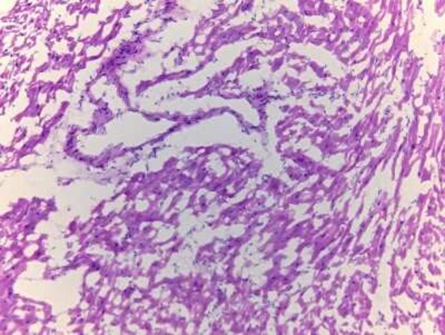 Novus Biologicals Heart Ventricle Tissue Slides (Adult Normal Left ...