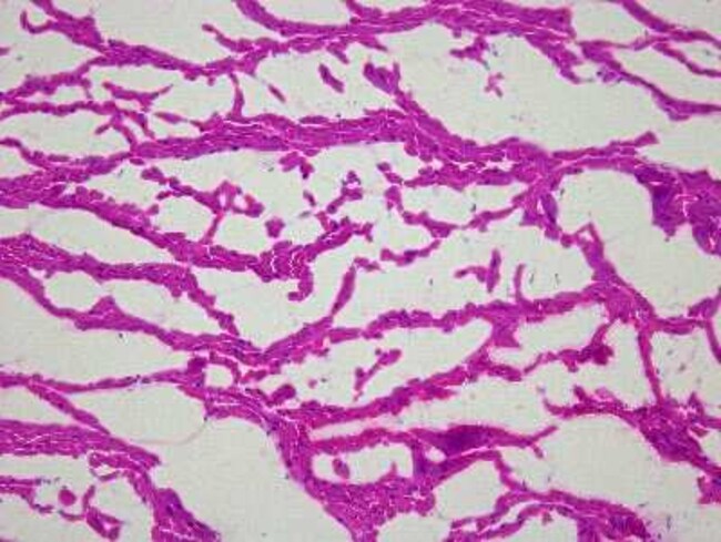 Novus Biologicals Heart Ventricle Tissue Slides (Arrhythmia Right ...